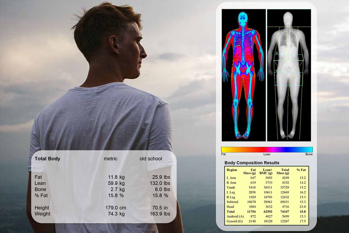 Healthy Male Example | Bodycomp Imaging