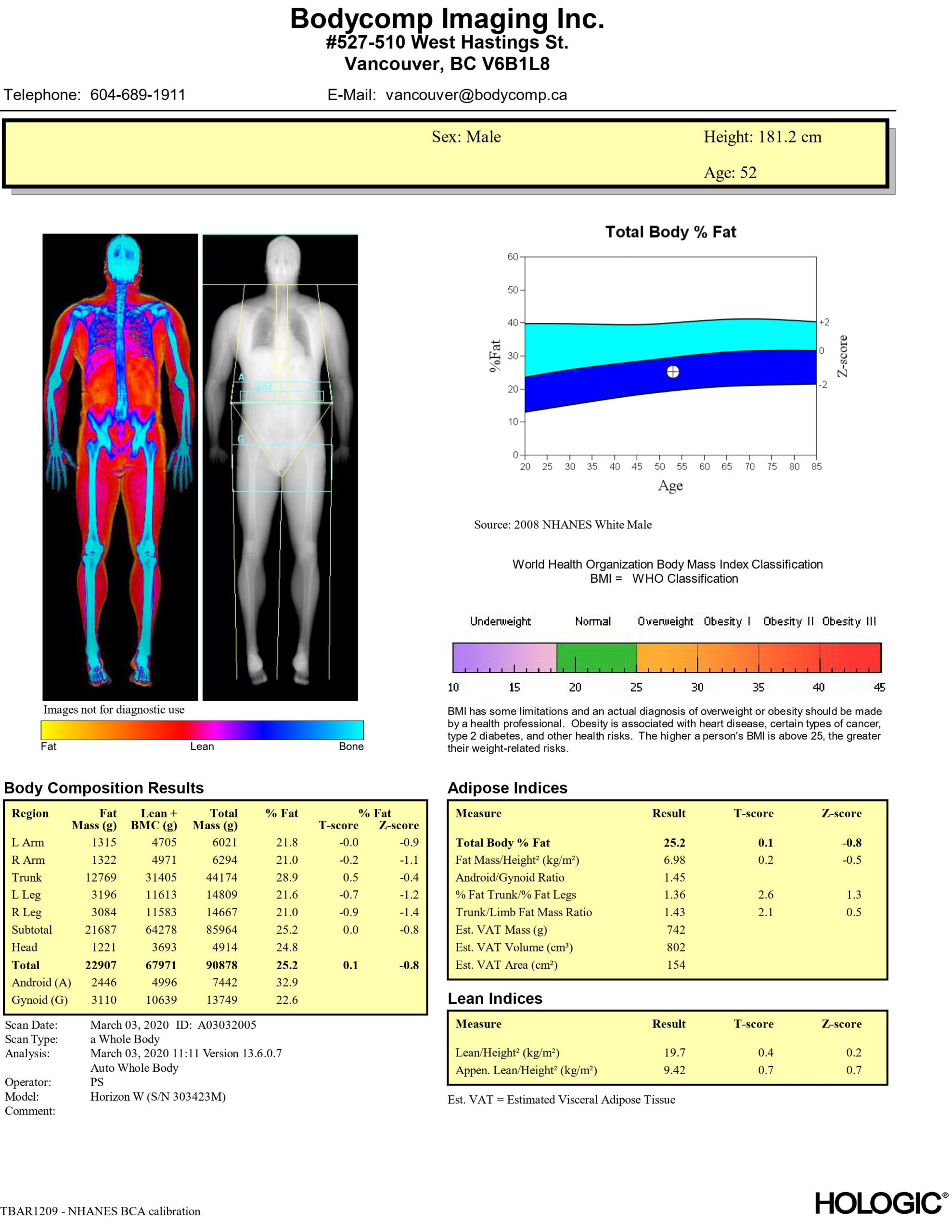 Sample Scans Bone Density Test Body Scan Dexa Sample Scans Bone Density Test Body Scan Dexa